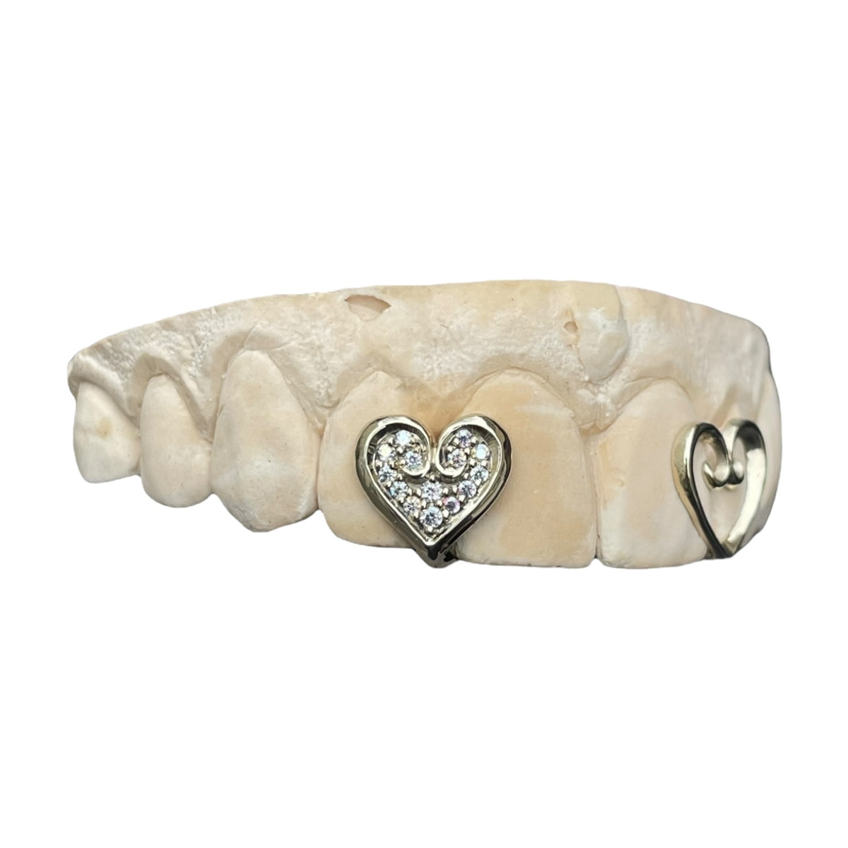 Valentins Grillz Youth Grillz Paris