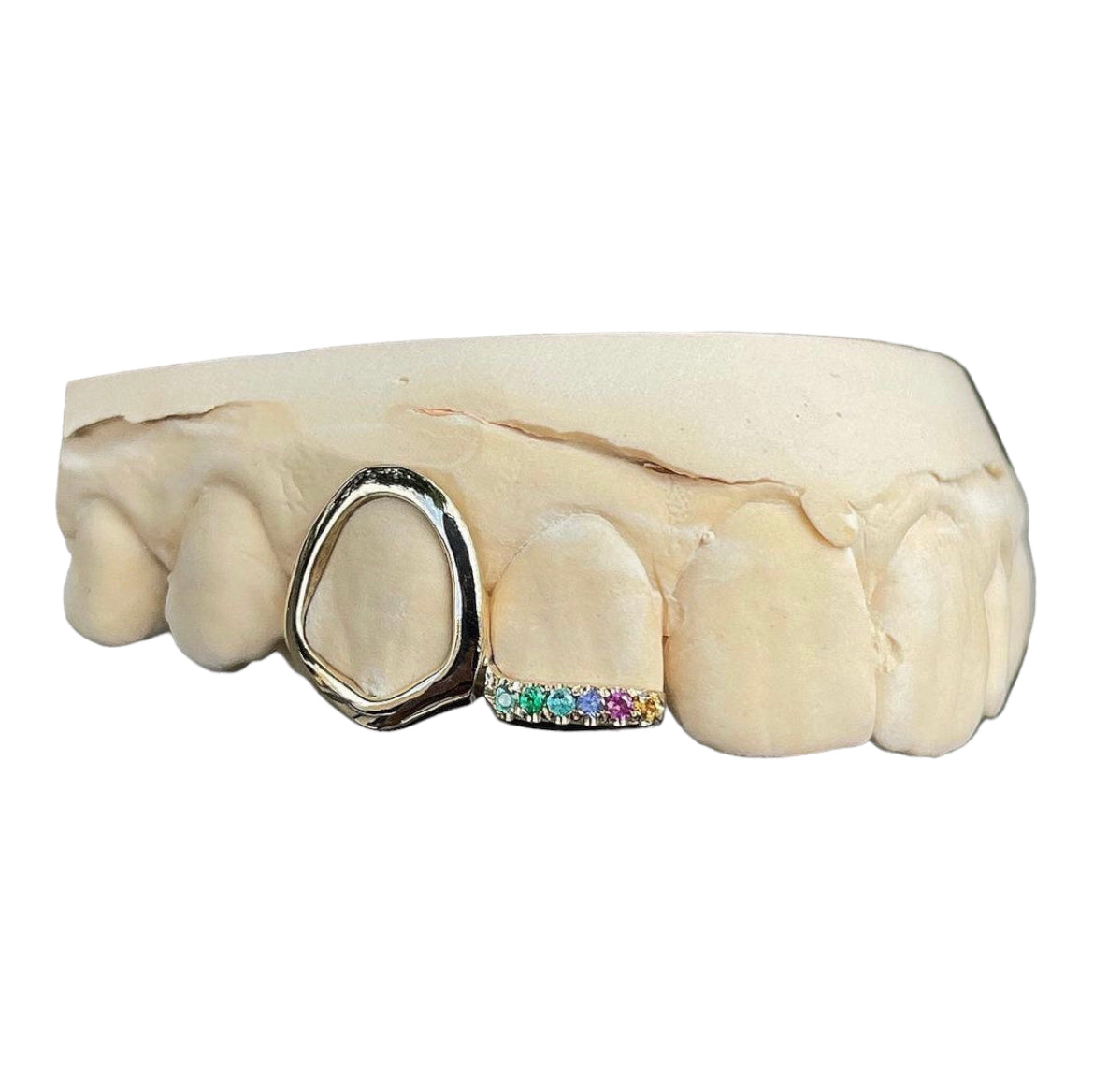 Jorja Diamonds Grillz Youth Grillz Paris